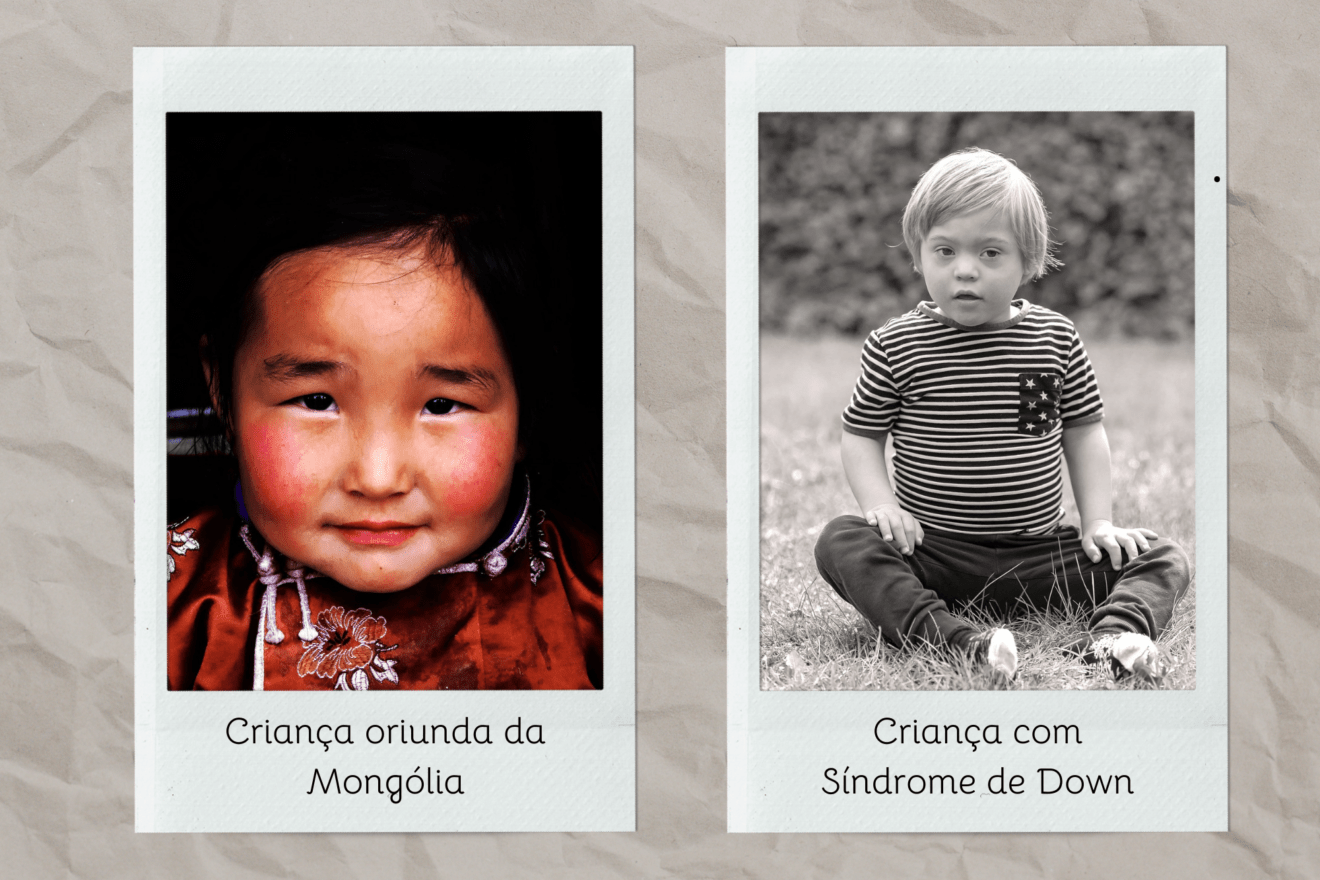 Síndrome de Down: a descoberta